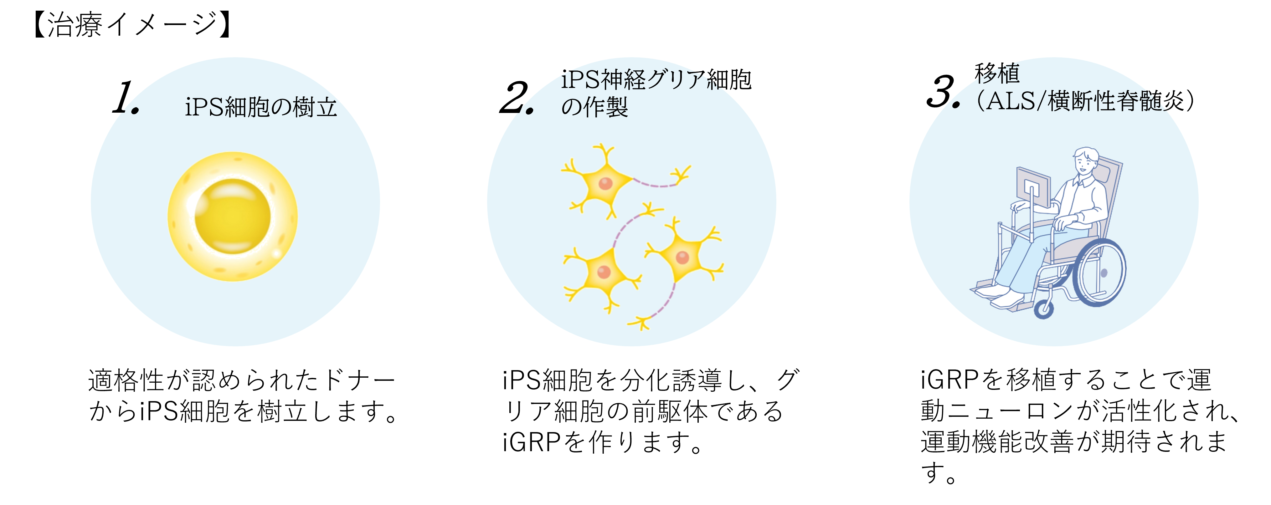 ALS/横断性脊髄炎・iPS神経グリア細胞 - 株式会社リプロセル